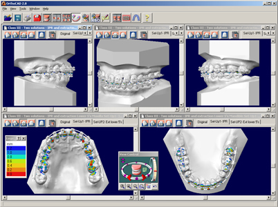Attenborough Dental Laboratory